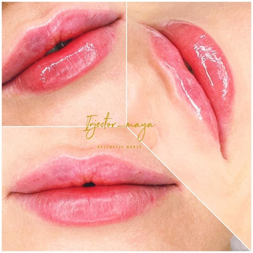 Baby Doll Lips - Injector Maya