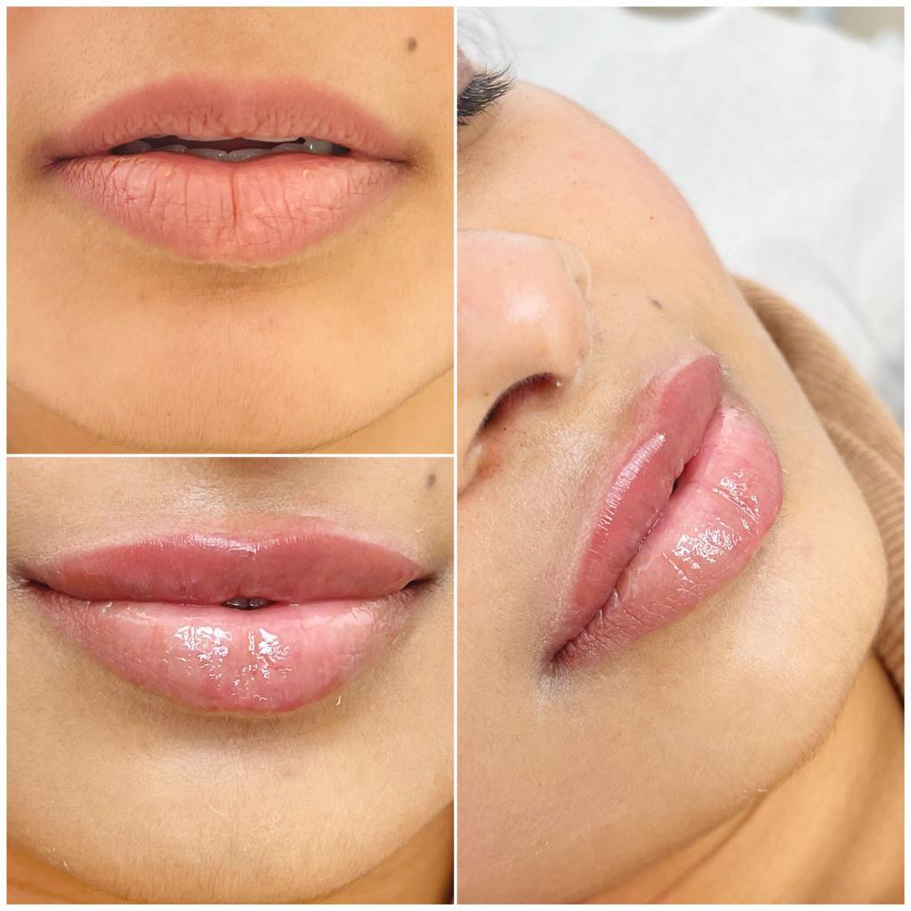 Baby Doll Lips - Injector Maya
