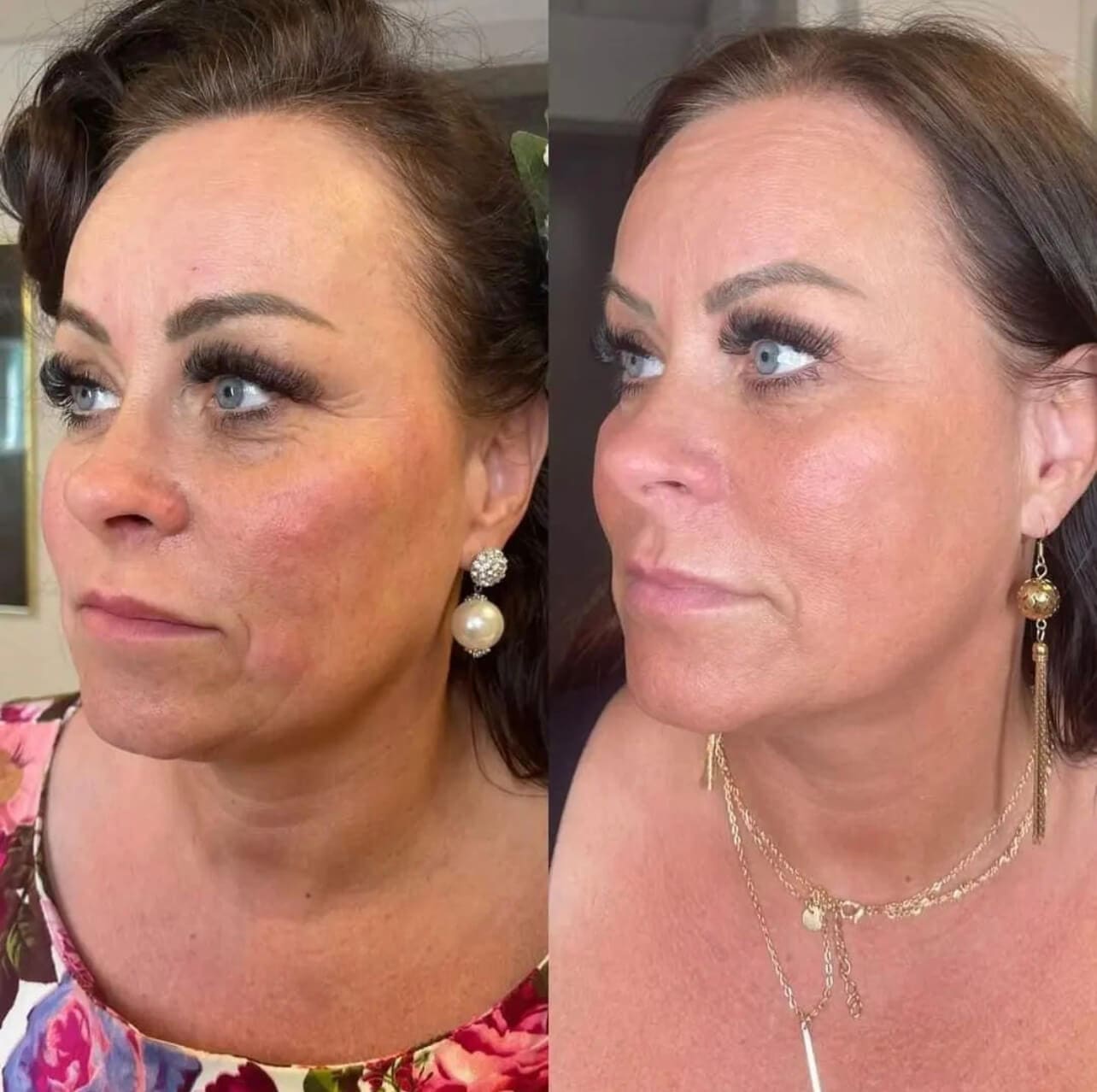 Ejal 40 - Injector Maya