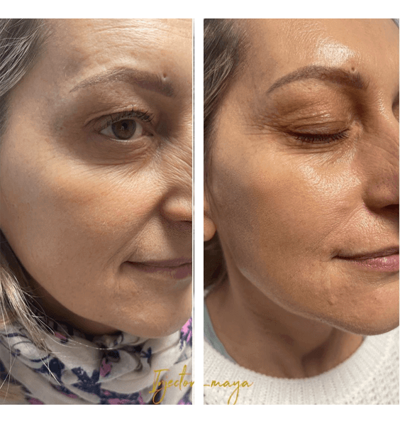 Ejal 40 - Injector Maya