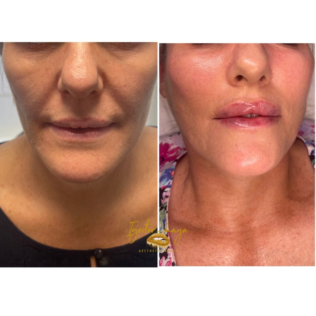 Jalurpo Super Hydro - Injector Maya