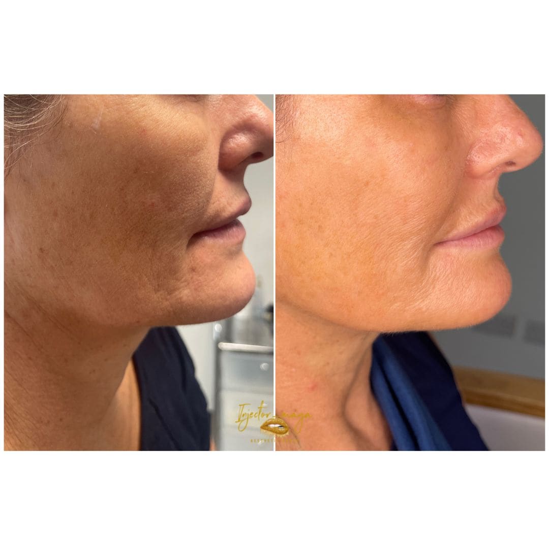 Jalurpo Super Hydro - Injector Maya