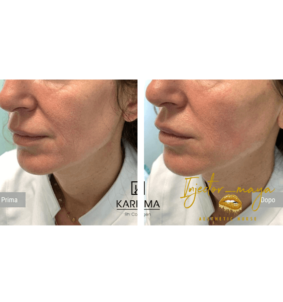 Jalurpo Super Hydro - Injector Maya