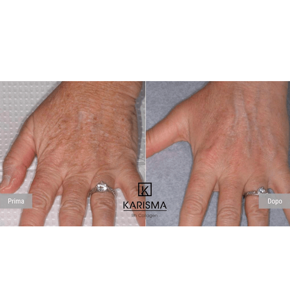 KARISMA - Injector Maya