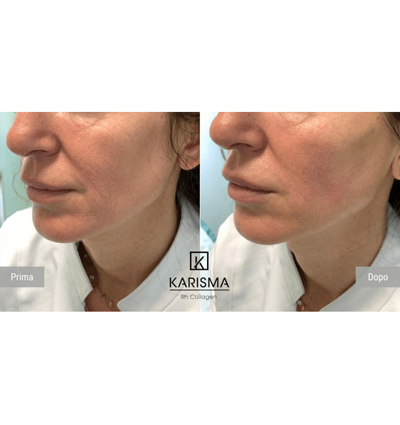 KARISMA - Injector Maya