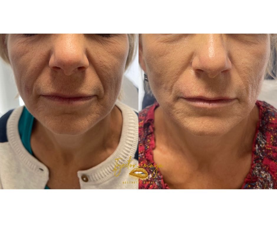 KARISMA - Injector Maya