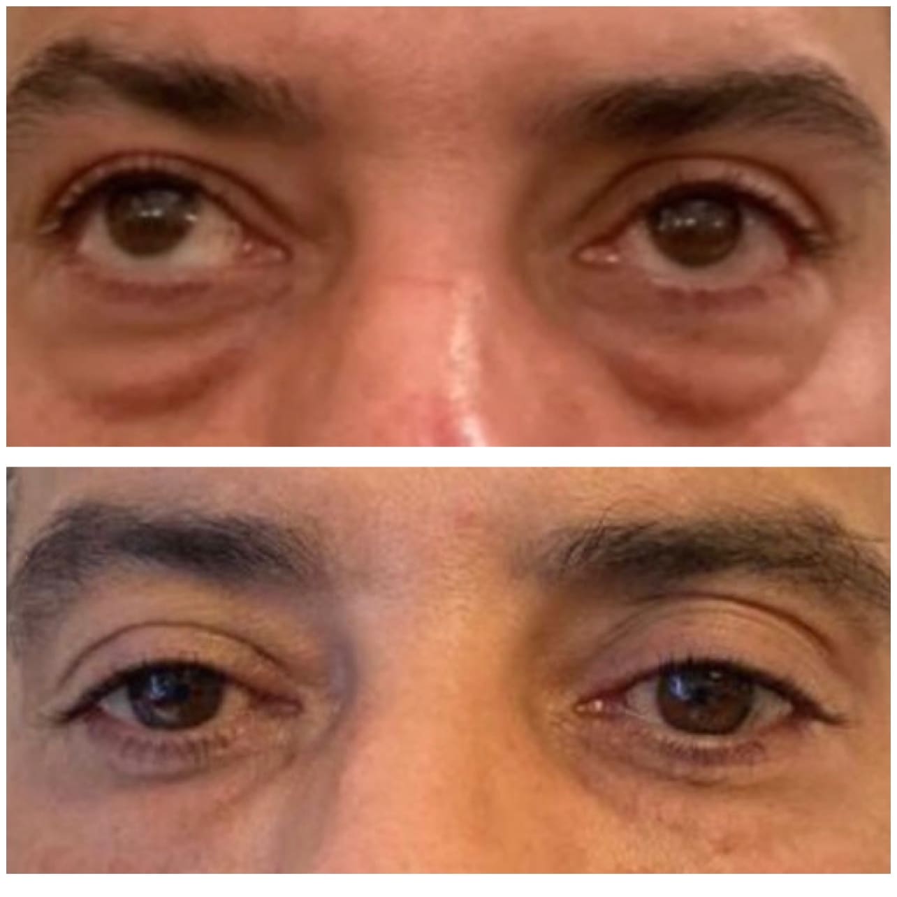 Nucleofill - Injector Maya