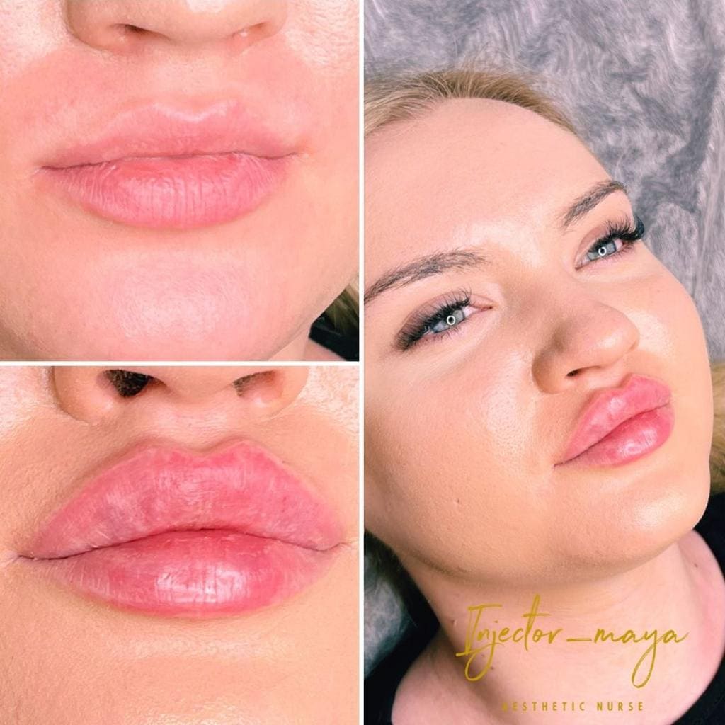 Russian Lips - Injector Maya